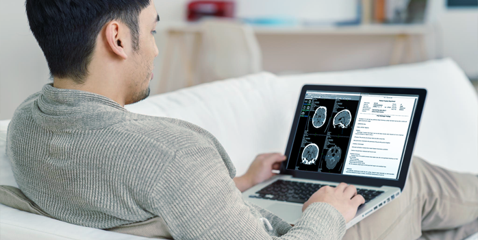 A Complete Guide to Selecting the Right PACS Model